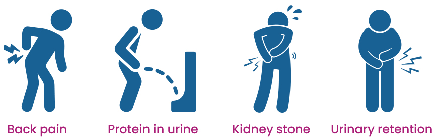 Urixan Active - Kidney Support